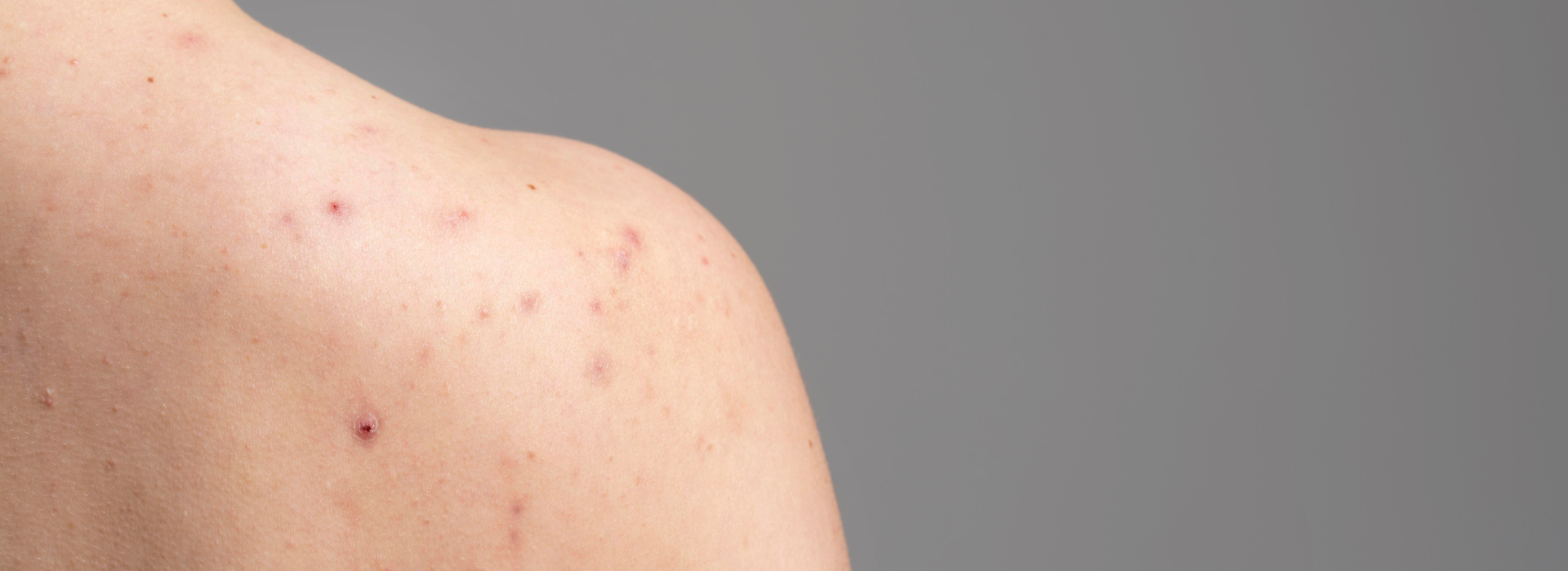 Red spots on skin: Causes & when to worry?